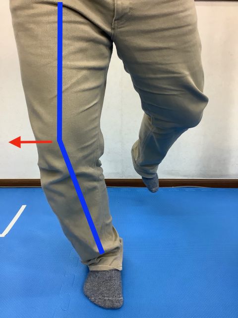 走ると膝の外側が痛い！【腸脛靭帯炎(ランナー膝)】の原因と対処法を紹介します！